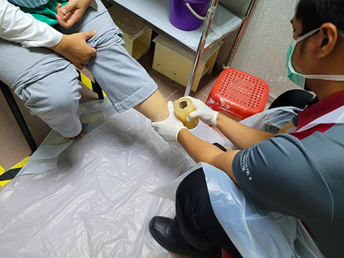 Unit Prostetik & Ortotik – Perkhidmatan Pemulihan