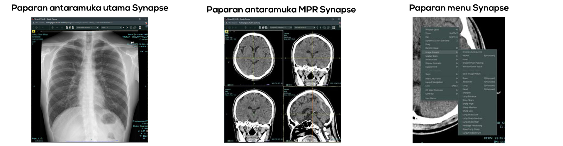 Pelaksanaan Picture Archiving And Communications System (PACS) Di ...