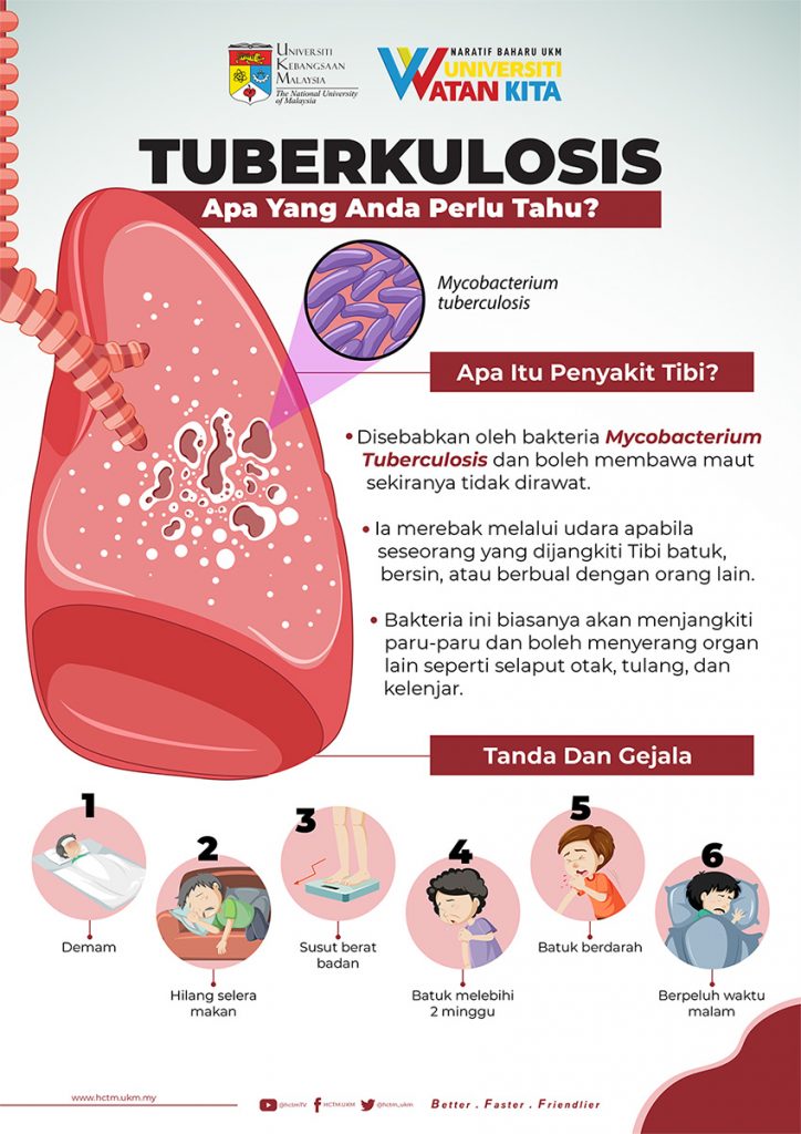 Tuberkulosis: Apa Perlu Anda Tahu? – Unit Keselamatan dan Kesihatan ...